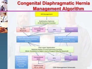 Congenital diaphragmatic hernia / Pediatric surgery | PPT