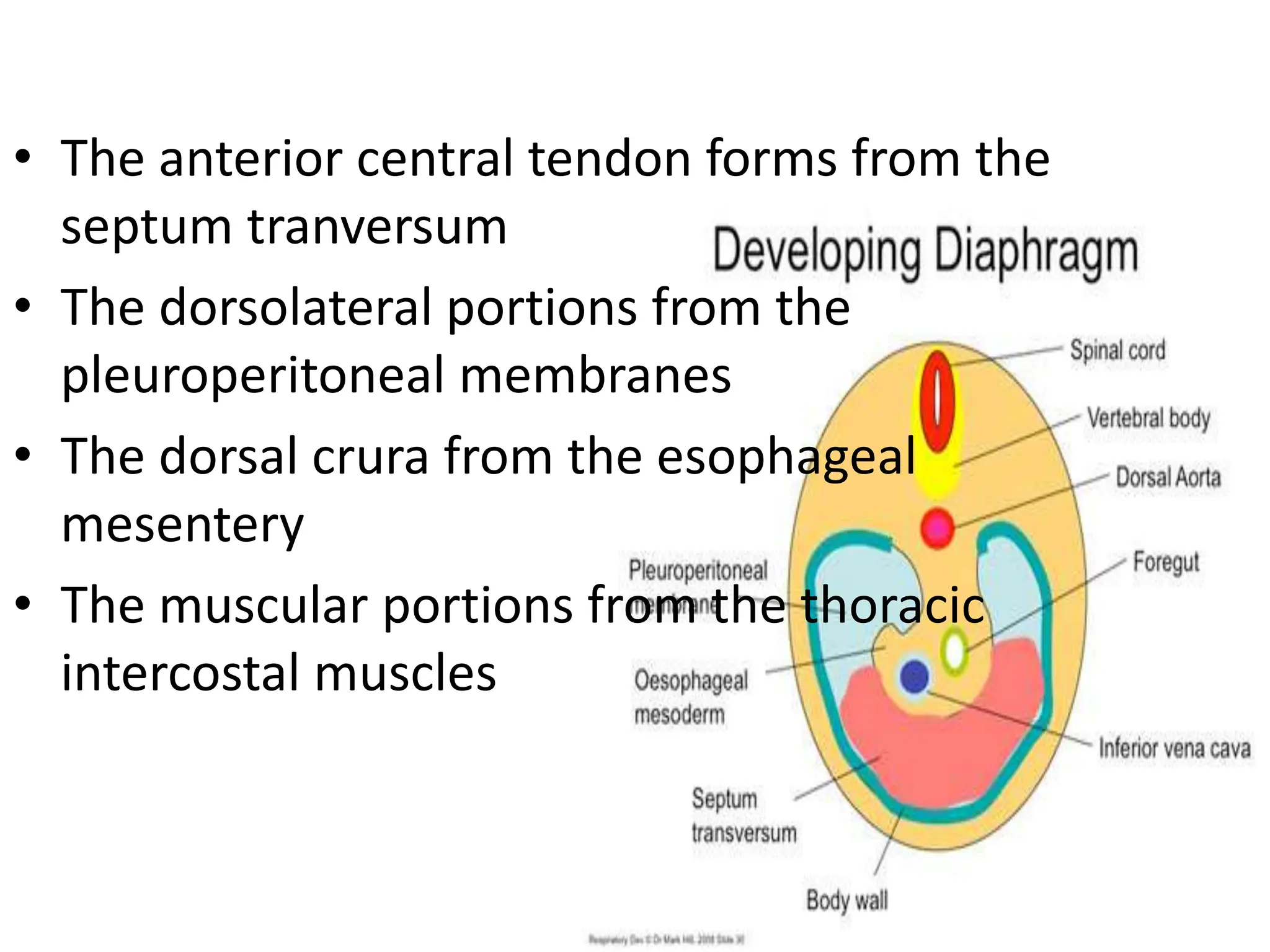 CONGENITAL DIAPHRAGMATIC HERNIA [Recovered].pptx