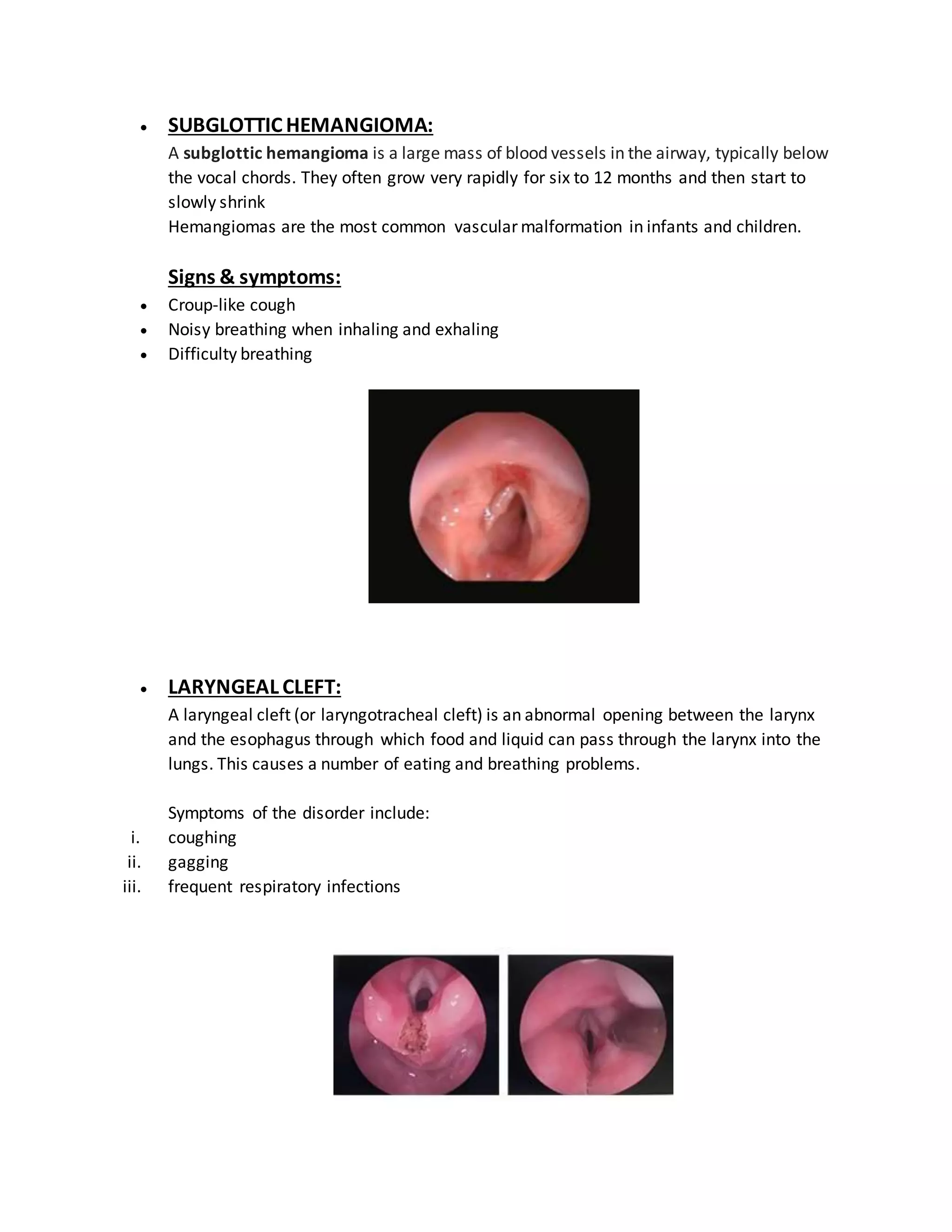 Diseases of larynx | DOCX