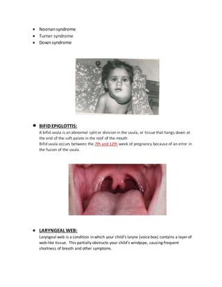 Diseases of larynx | DOCX
