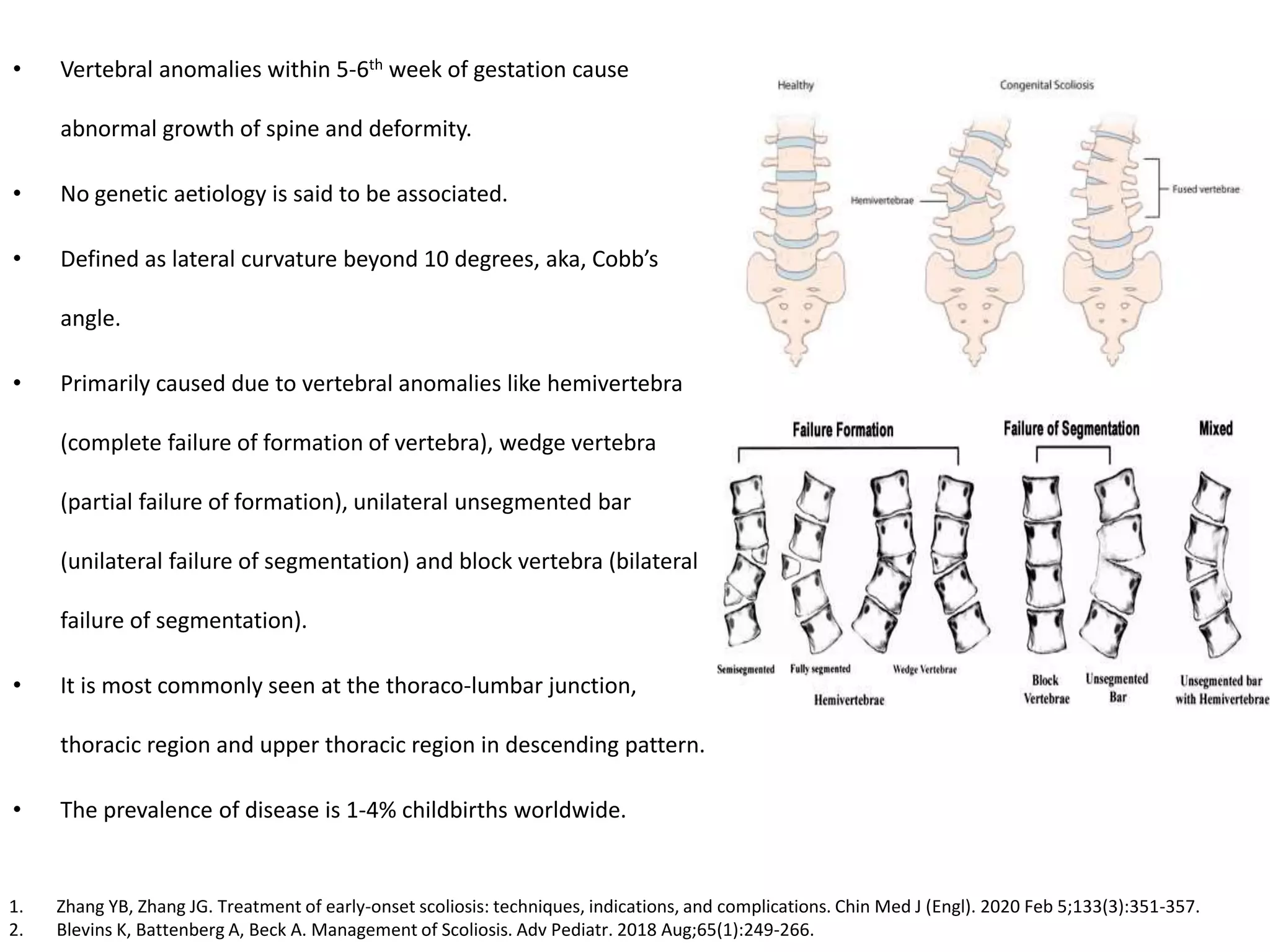 Congenital diseases causing Spinal Cord Compression | PPTX