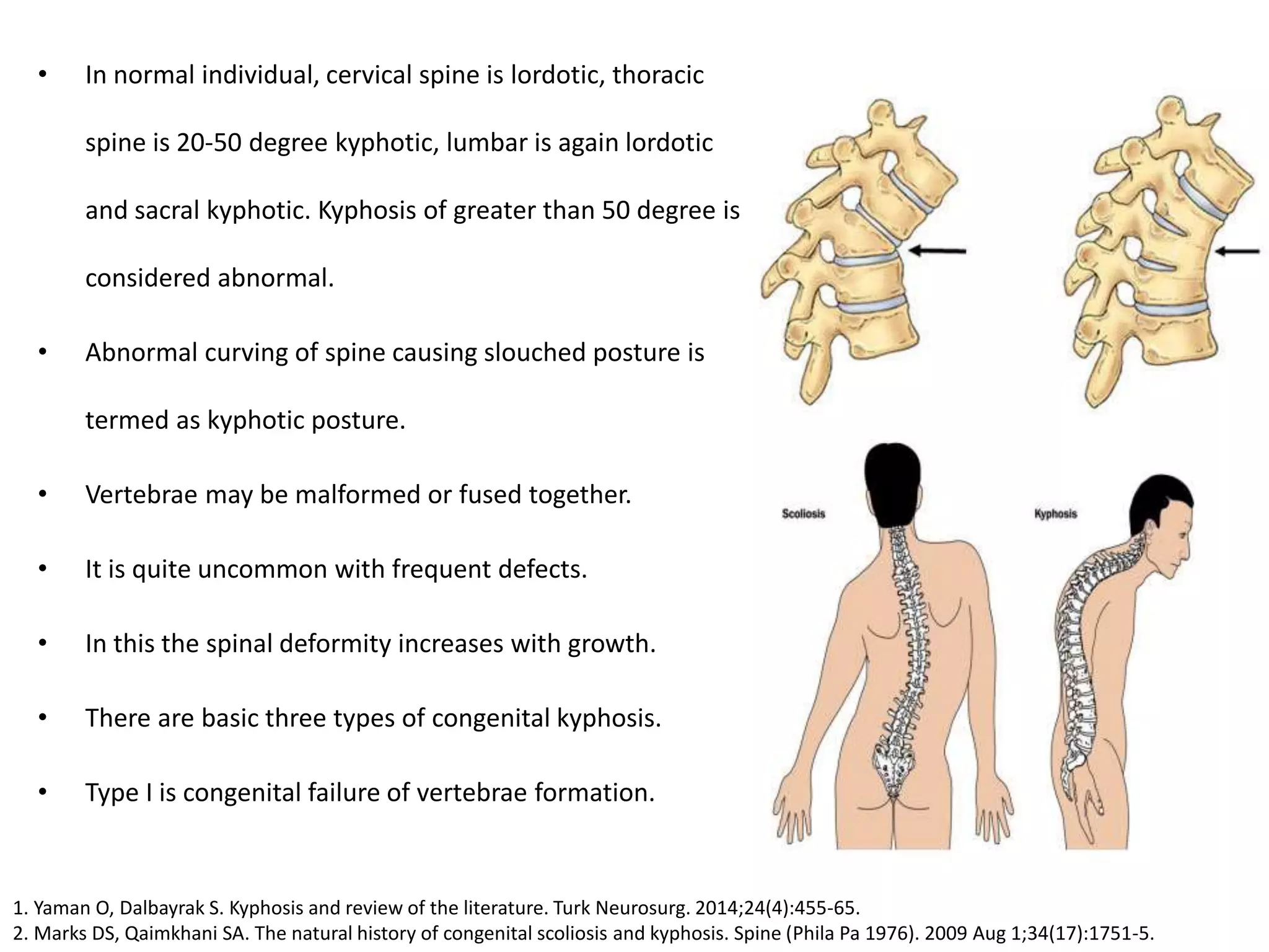 Congenital diseases causing Spinal Cord Compression | PPTX