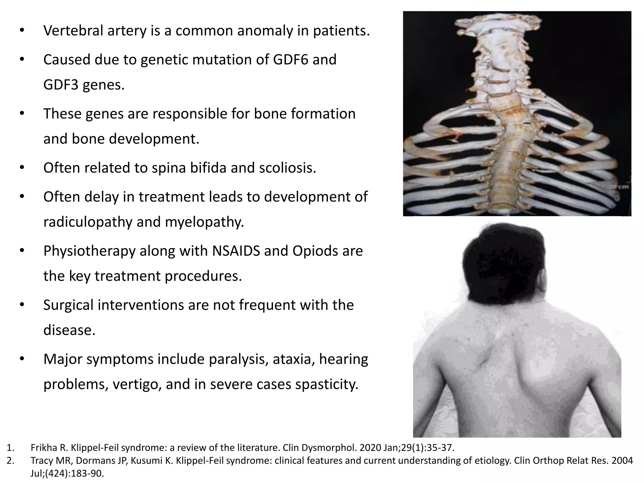 Congenital diseases causing Spinal Cord Compression | PPTX