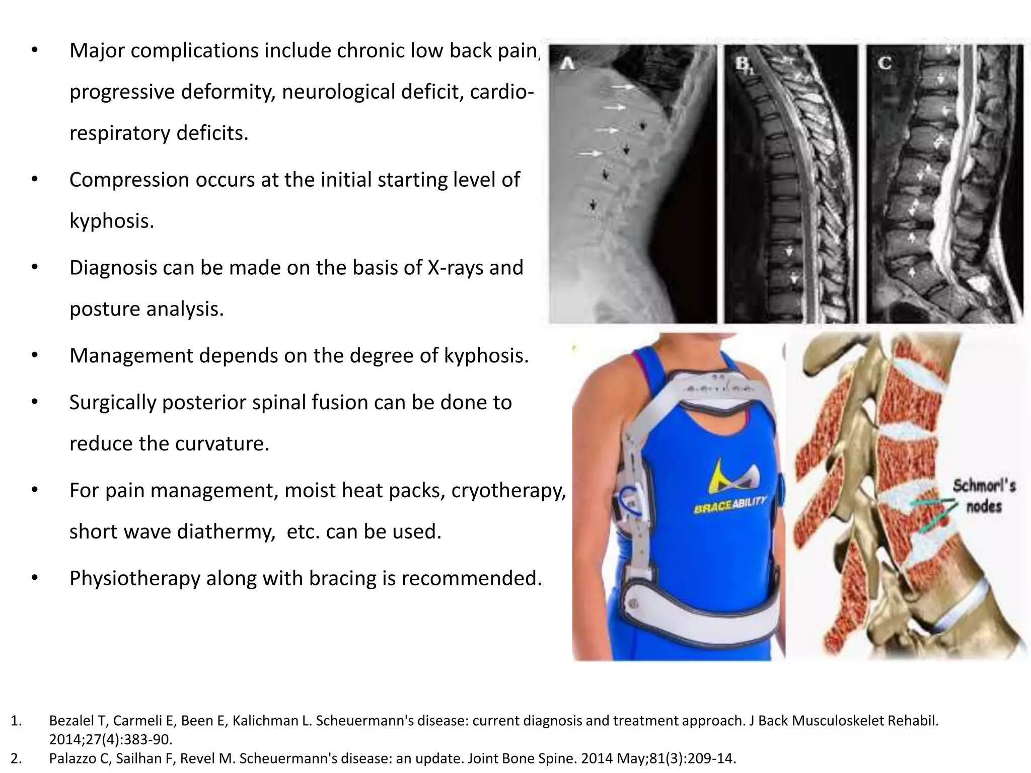 Congenital diseases causing Spinal Cord Compression | PPTX