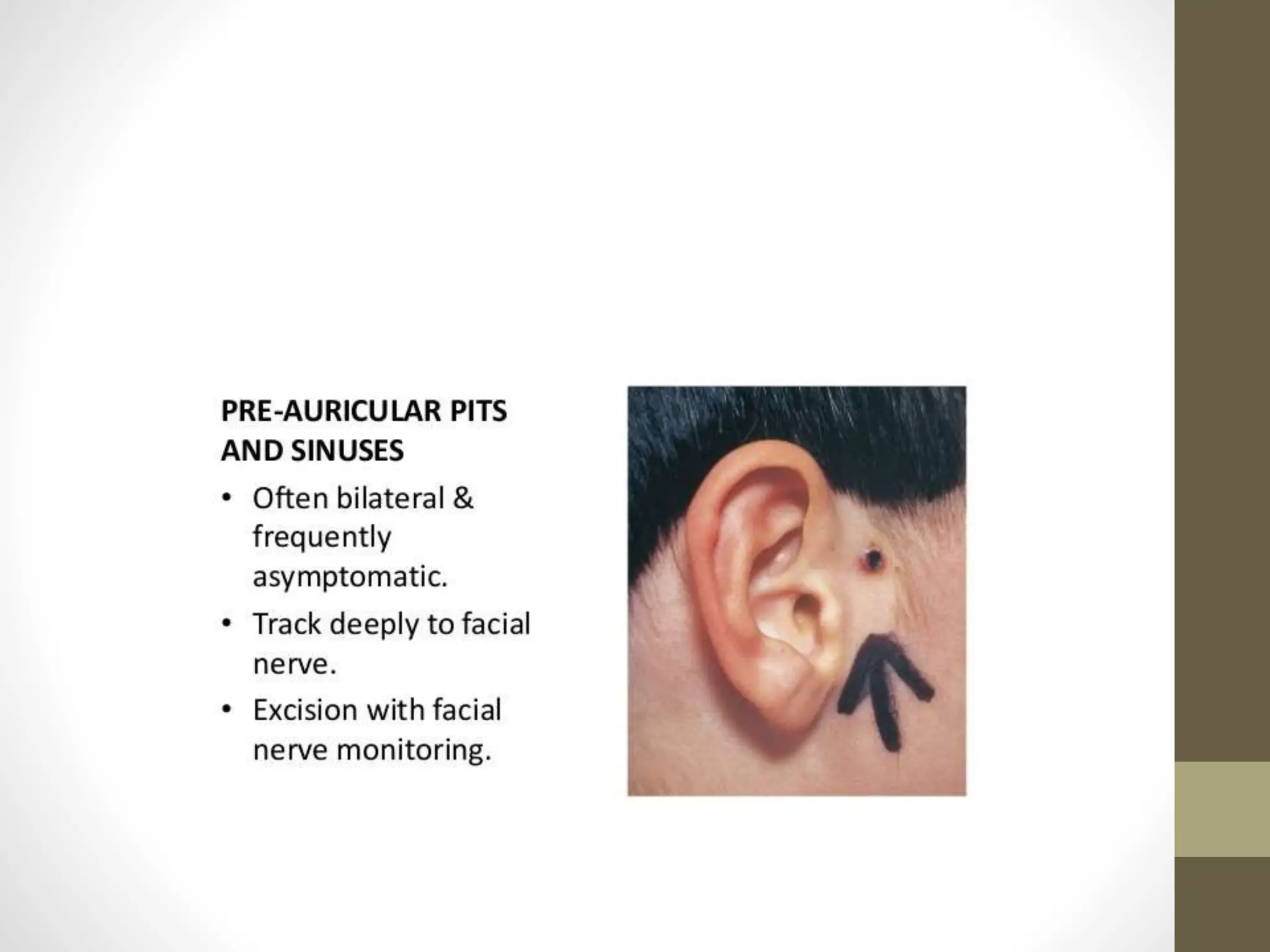 CONGENITAL DISEASES OF THE EAR.pptx