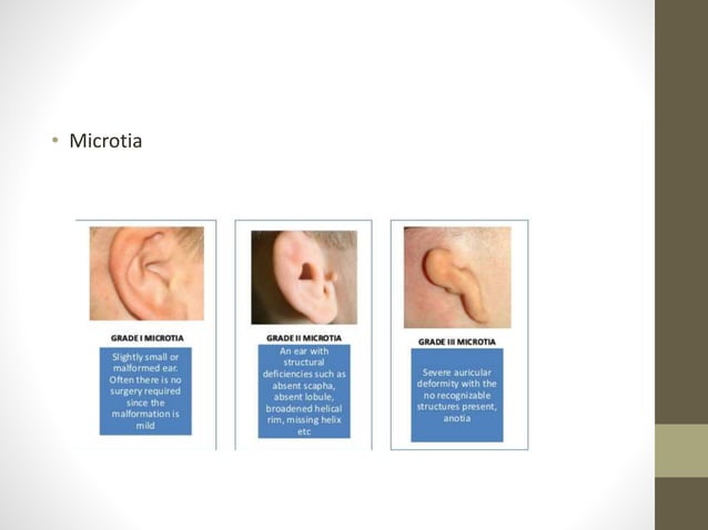 CONGENITAL DISEASES OF THE EAR.pptx