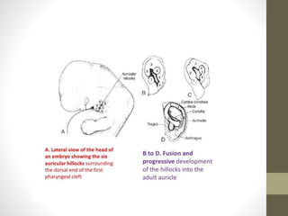 CONGENITAL DISEASES OF THE EAR.pptx