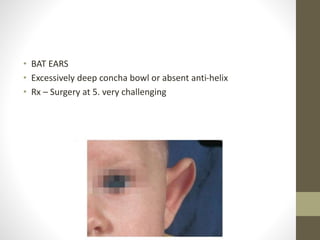CONGENITAL DISEASES OF THE EAR.pptx