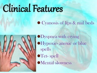 Congenital Diseases of the Heart in Children.pptx