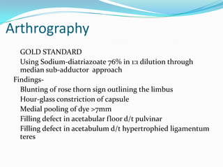 Congenital dislocation of hip_UTSAV | PPTX
