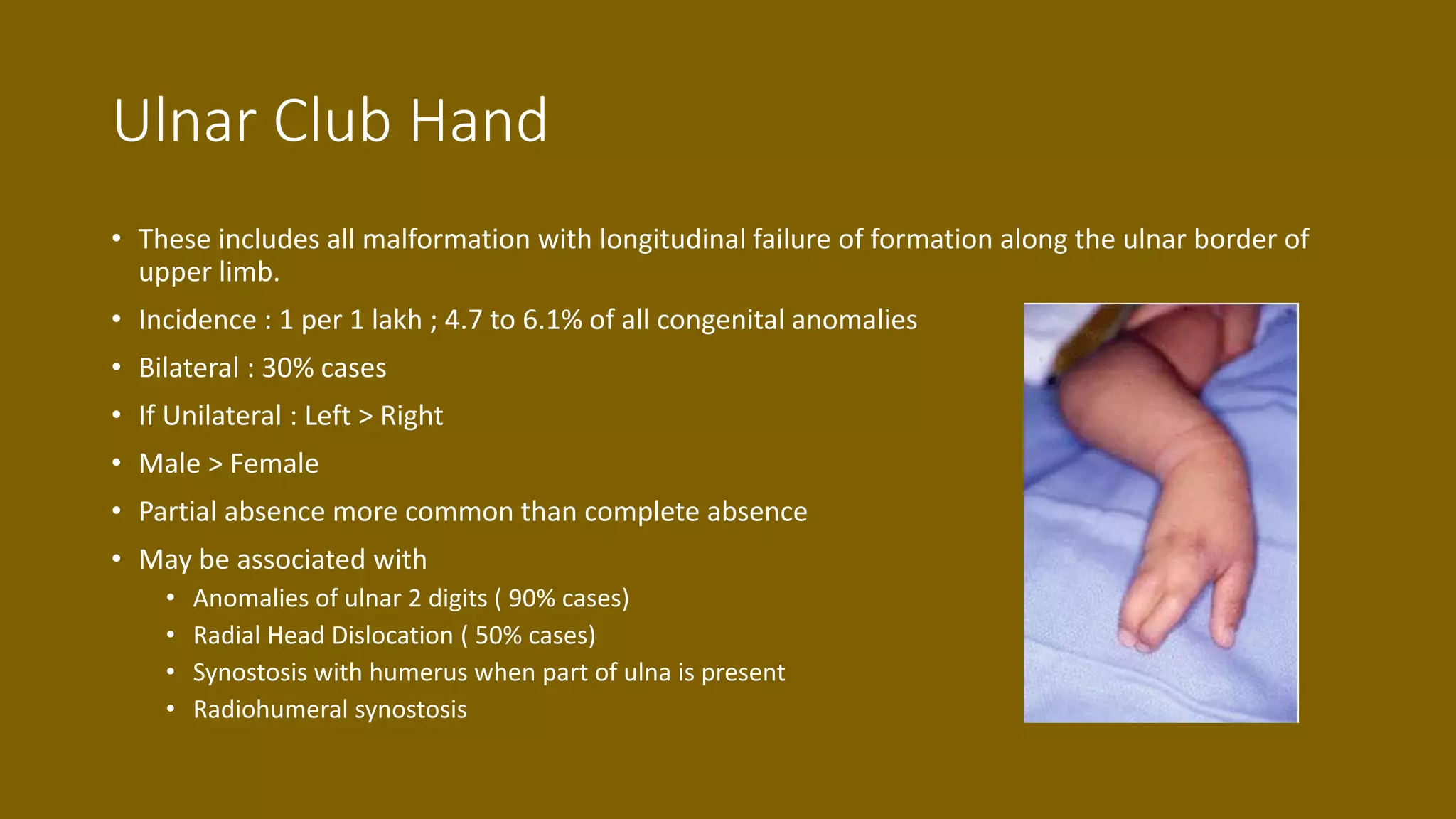 upper limb congenital anomalies | PPTX