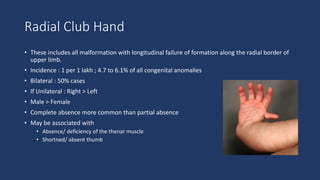 upper limb congenital anomalies | PPTX