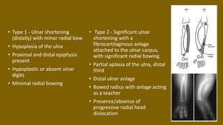 upper limb congenital anomalies | PPTX