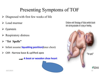 Congenital disorders.ppt