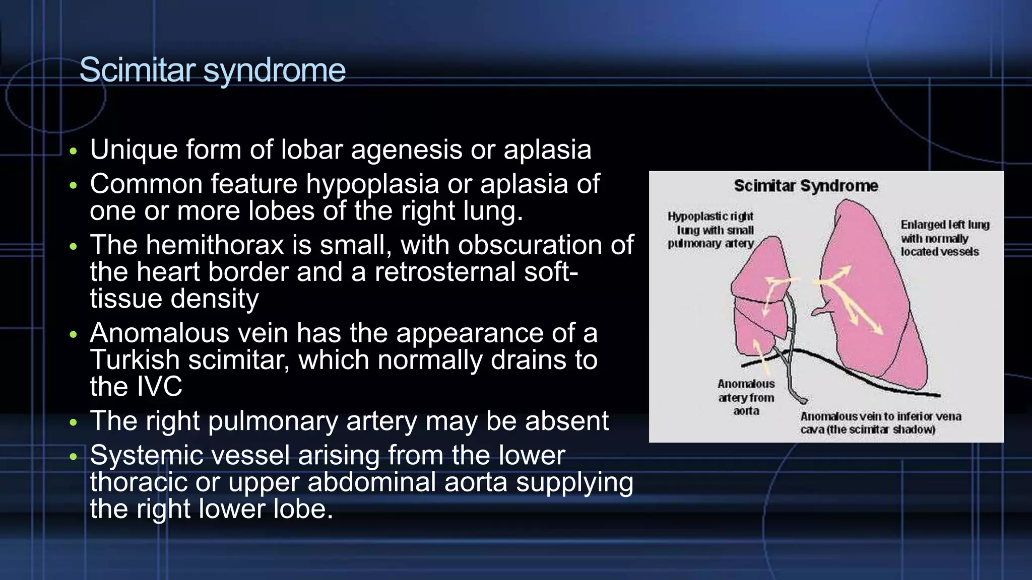 CONGENITAL DISORDERS OF LUNG | PPTX