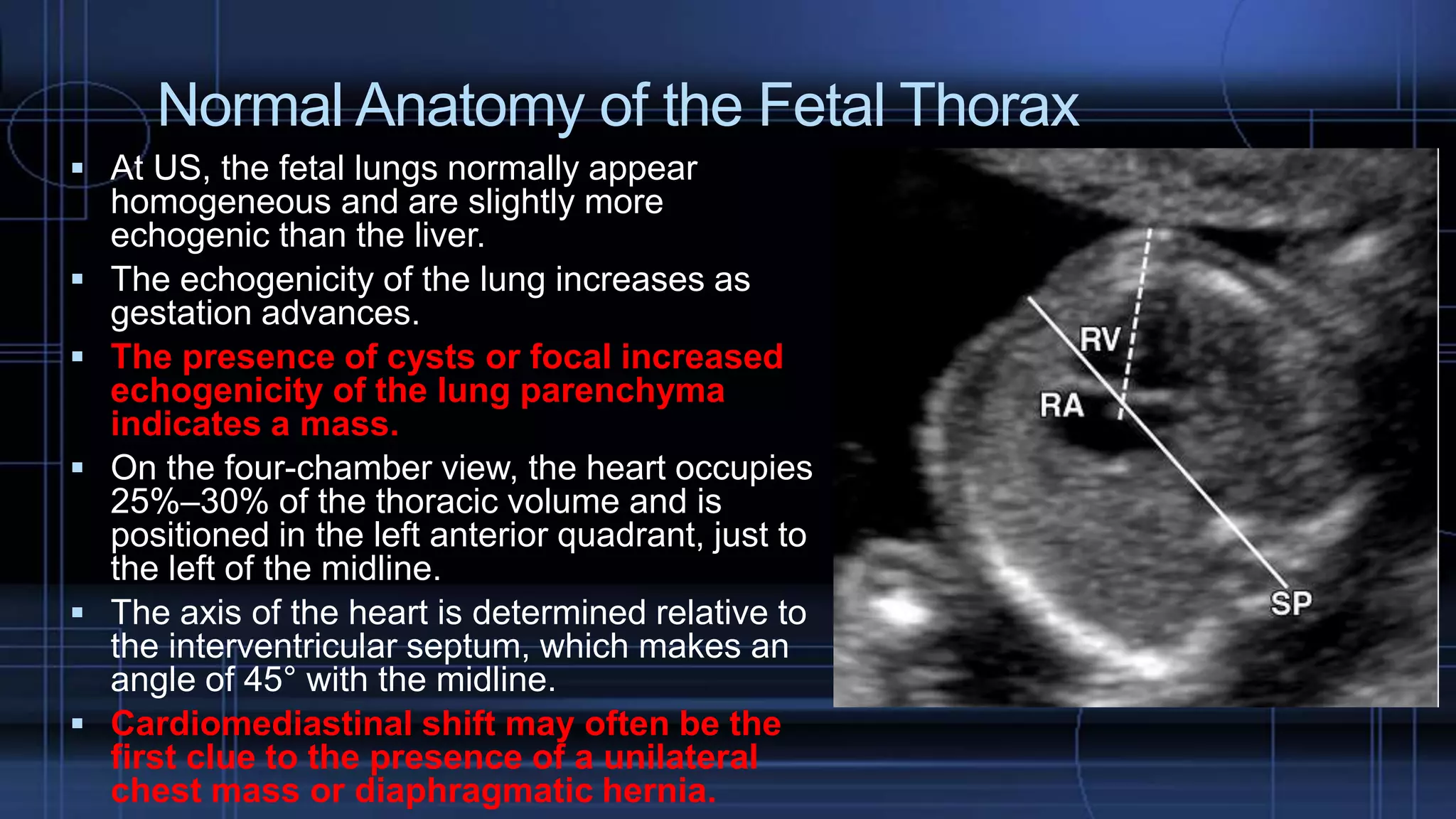 CONGENITAL DISORDERS OF LUNG | PPTX