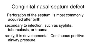 Congenital disorders of nose | PPT