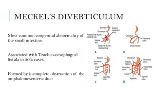 Congenital diverticula .pptx