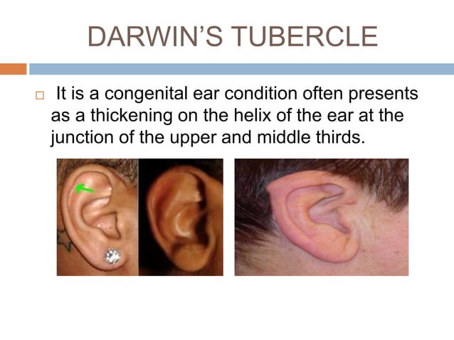 Congenital ear deformities | PPTX | Pregnancy | Reproductive Health