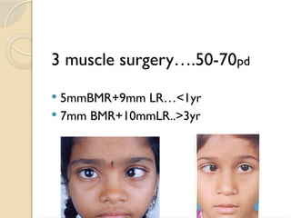 Congenital Esotropia diagnosis and management.pptx