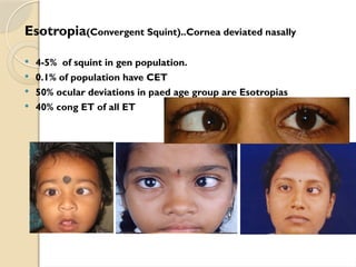 Congenital Esotropia diagnosis and management.pptx