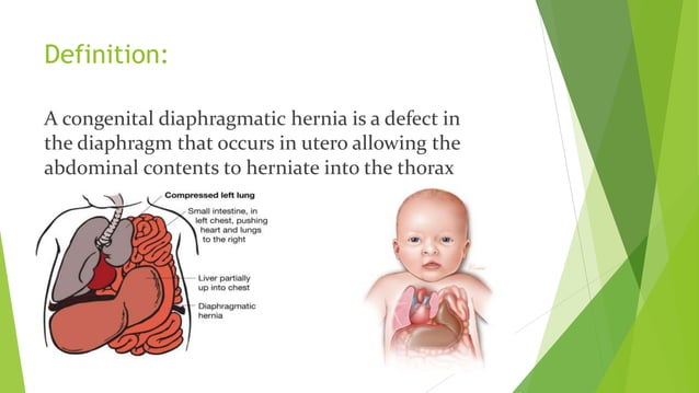 Congenital gaphragmatic hernia