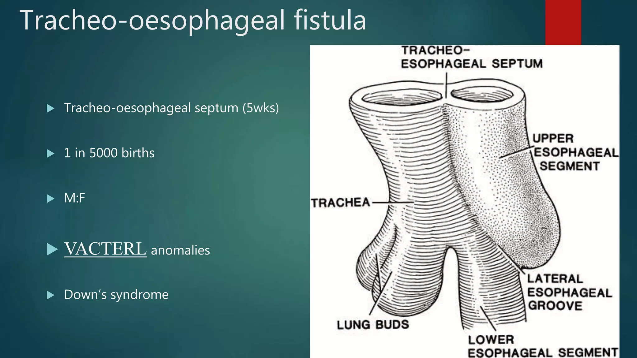 congenitalgastrointestinalanomalies-161121183124.pdf