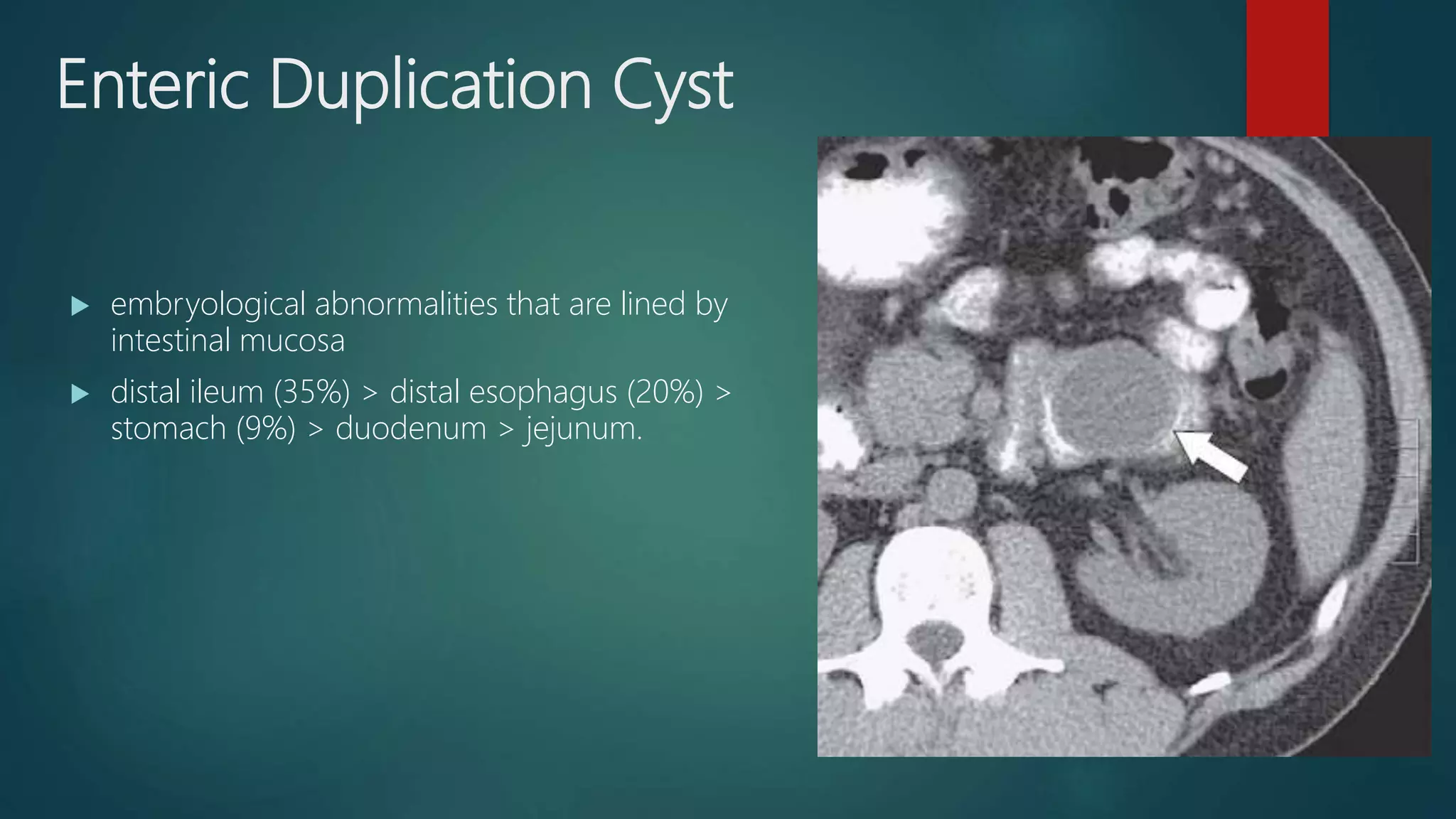 congenitalgastrointestinalanomalies-161121183124.pdf