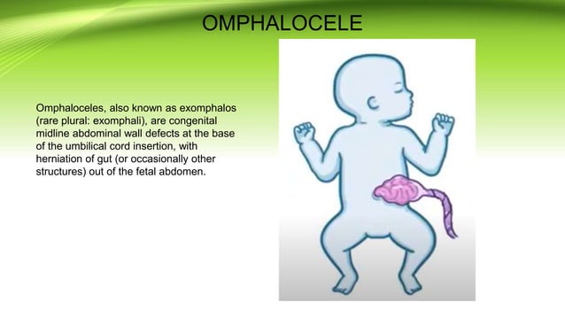 congenitalgastrointestinalanomalies-161121183124.pptx