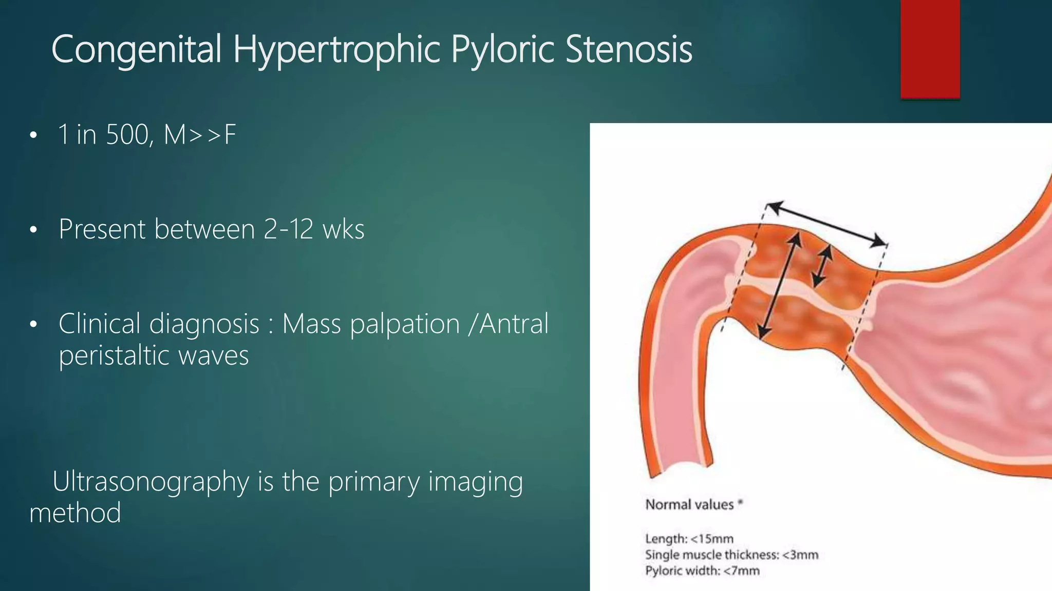 Congenital gastrointestinal anomalies | PPTX