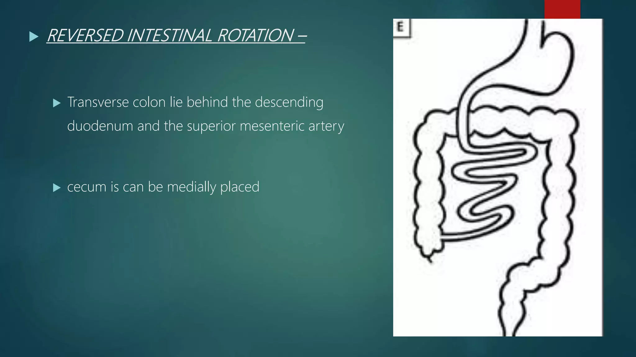 Congenital gastrointestinal anomalies | PPTX