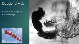 Congenital gastrointestinal anomalies | PPTX