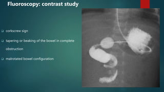 Congenital gastrointestinal anomalies | PPTX