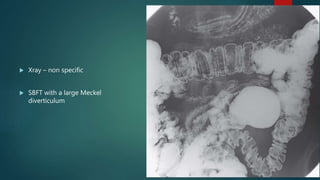 Congenital gastrointestinal anomalies | PPTX