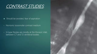Congenital gastrointestinal anomalies | PPTX