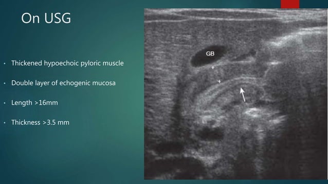 Congenital Gastrointestinal Anomalies