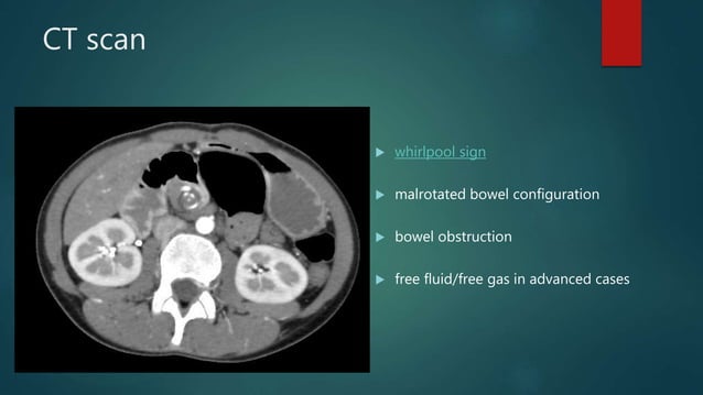 Congenital gastrointestinal anomalies