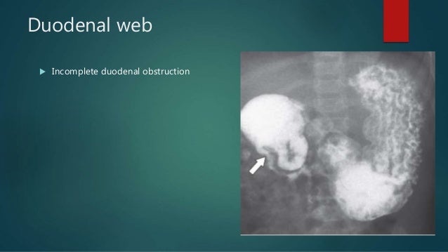 Congenital gastrointestinal anomalies