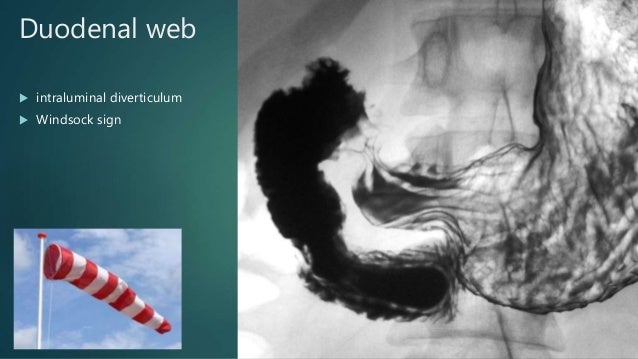Congenital Gastrointestinal Anomalies