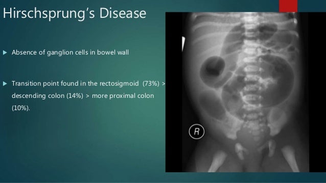Congenital Gastrointestinal Anomalies