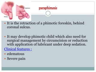 Congenital genito urinary disorders | PPTX