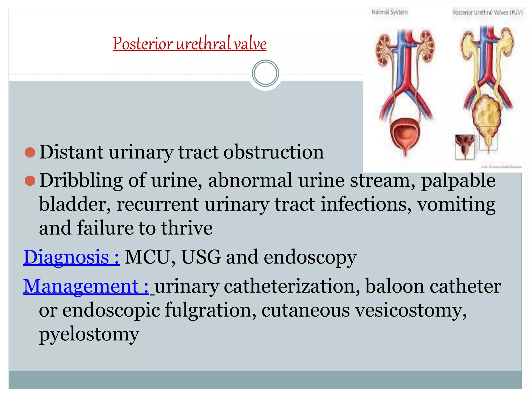 CONGENITAL GENITO URINARY DISORDERS.pptx