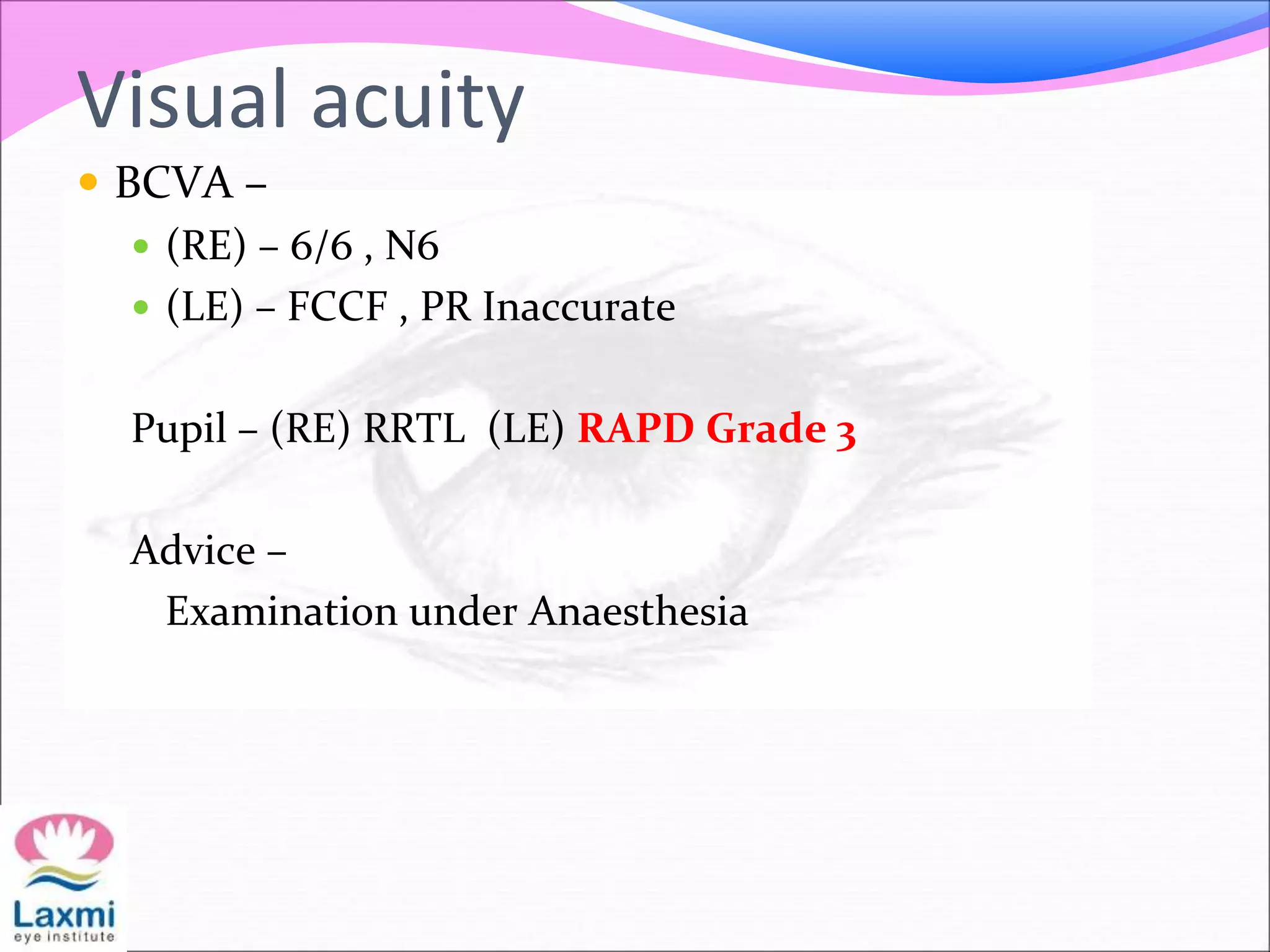 Congenital glaucoma | PPTX