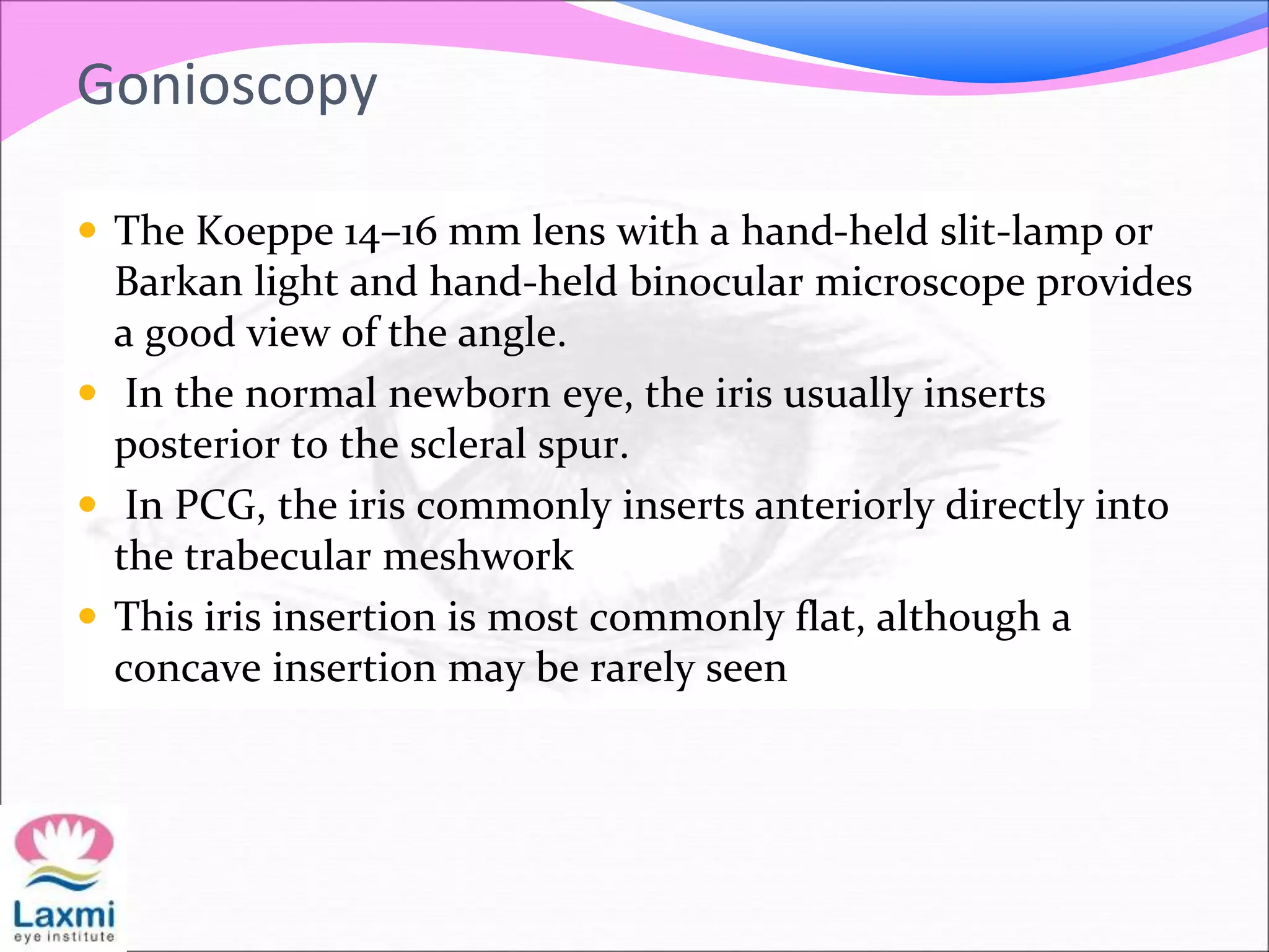 Congenital glaucoma | PPTX