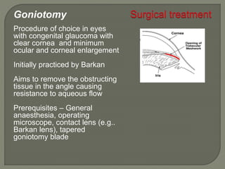 Congenital glaucoma.pptx