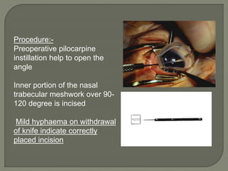 Congenital glaucoma.pptx