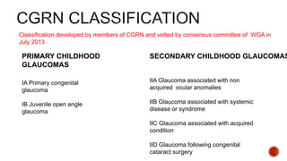 Congenital Glaucoma | PPTX