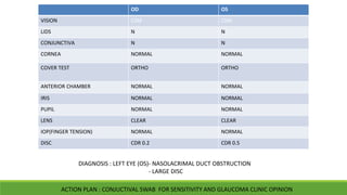 Congenital glaucoma -Evaluation | PPTX