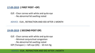 Congenital glaucoma -Evaluation | PPTX