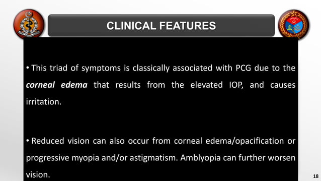 CONGENITAL GLAUCOMA - USMAN.pptx
